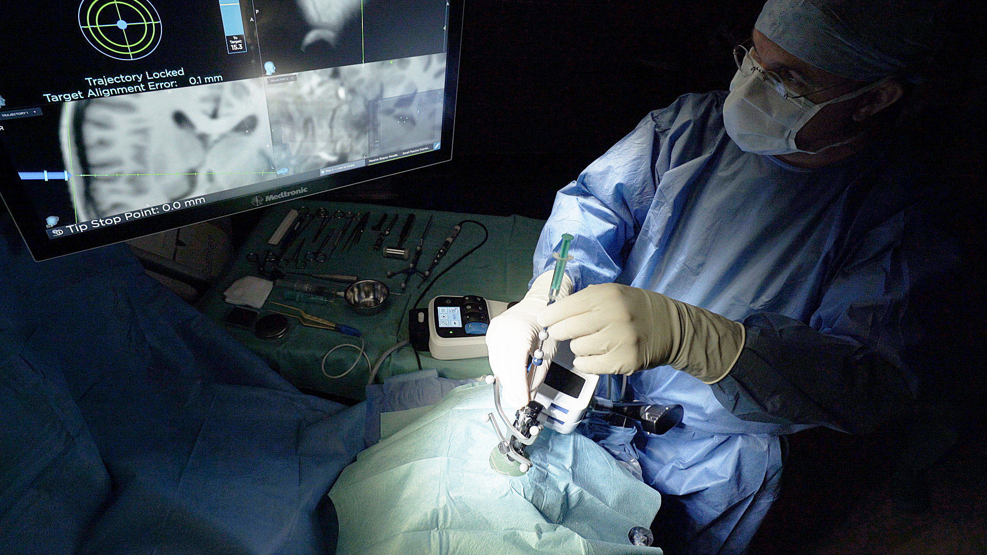 Gehirntumor | Gliom | Glioblastom | Prof.Dr.Wolfsberger